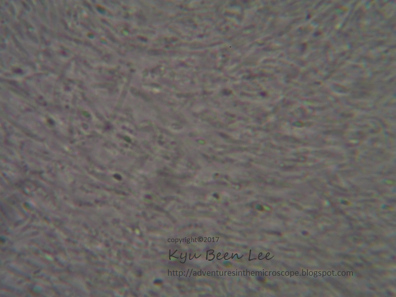 Micro World What Is Bacillus Subtilis Natto