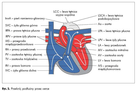 Serce Wiktorii: Opis wady serca