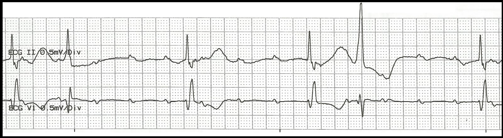 EKG Rhythm Strip Quiz 142
