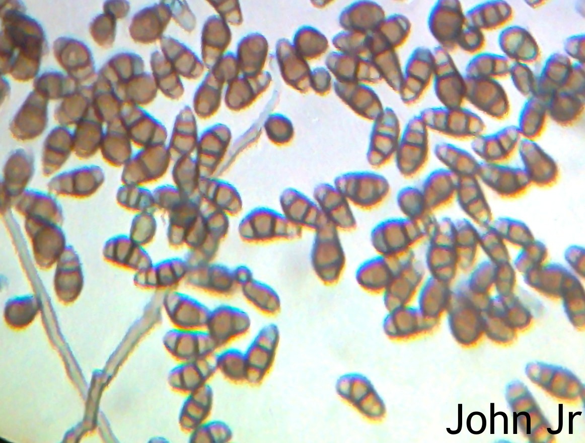 Um Convite à Biomedicina: Curvularia e sua relação com a agricultura