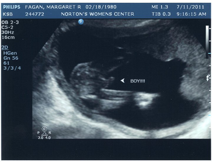 Baby Fagan 2011: 07/11/2011-5 Month Sonogram :)
