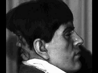 Lucila Castro Diaz "L.C.D": El caso de Edward Mordrake "El hombre de ...