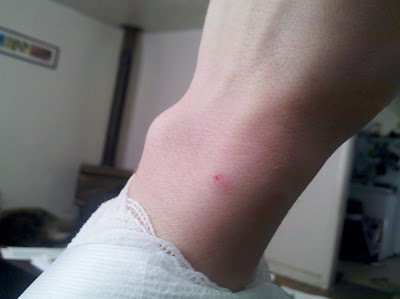 Evolution Dog Training: Proof of Bite Inhibition