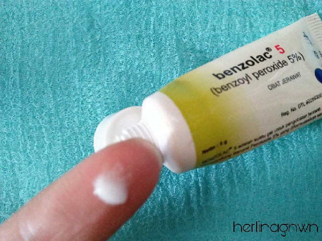 BEAUTY BLOG by Herlinagnwn: REVIEW BENZOLAC 5 : Obat jerawat terampuh ...