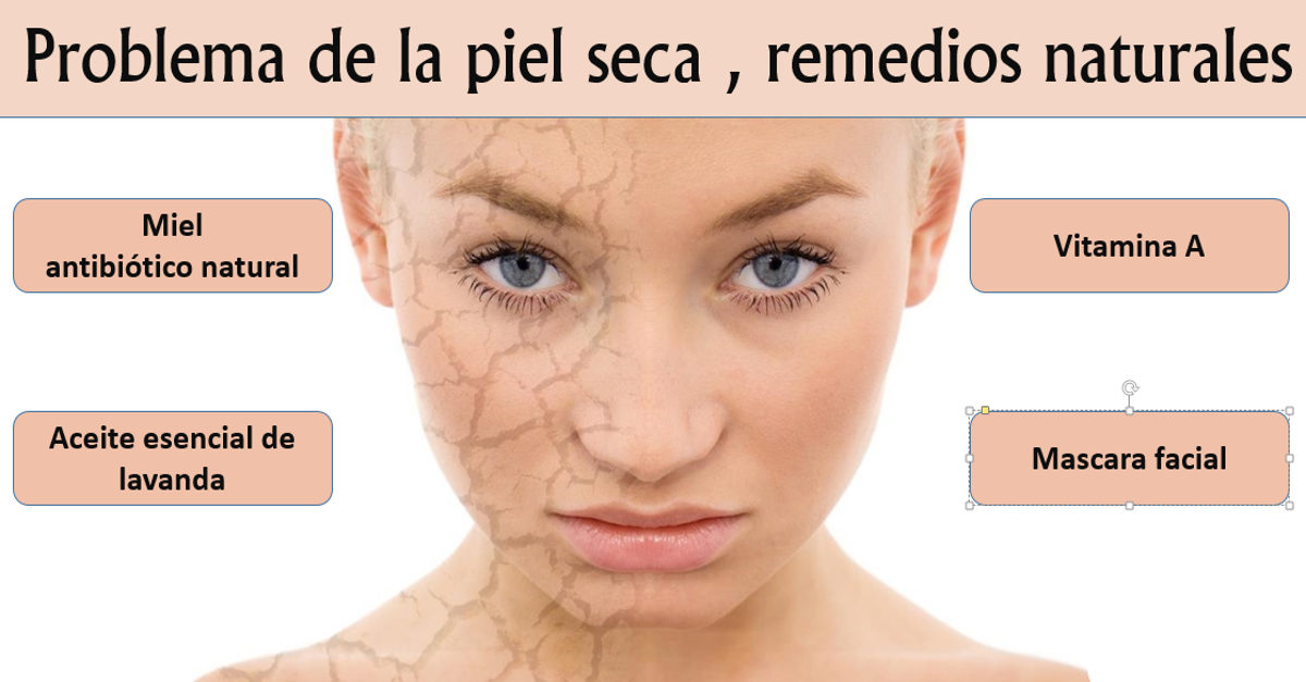 Problema de la piel seca , remedios naturales - Propiedades y ...