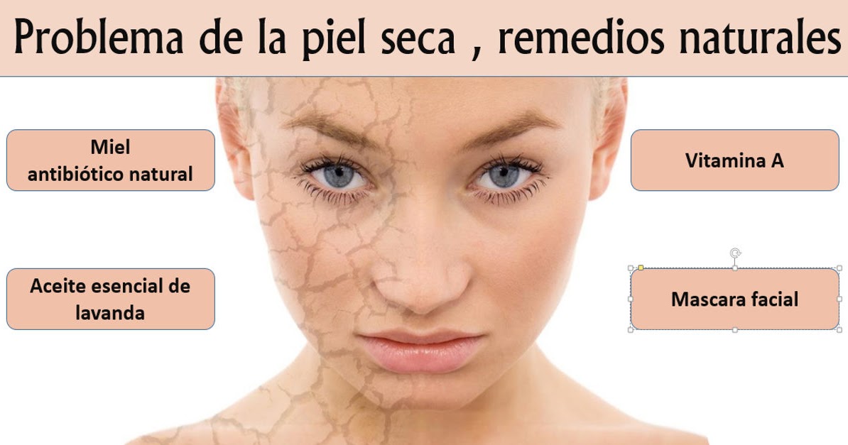 Problema de la piel seca , remedios naturales - Propiedades y ...