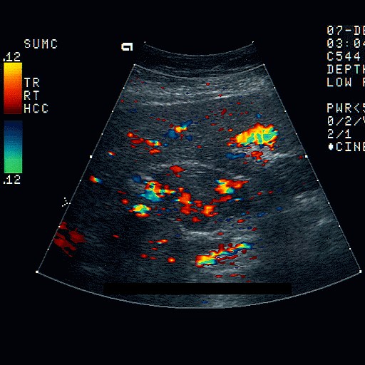 Doctor's knowledge: Liver function test