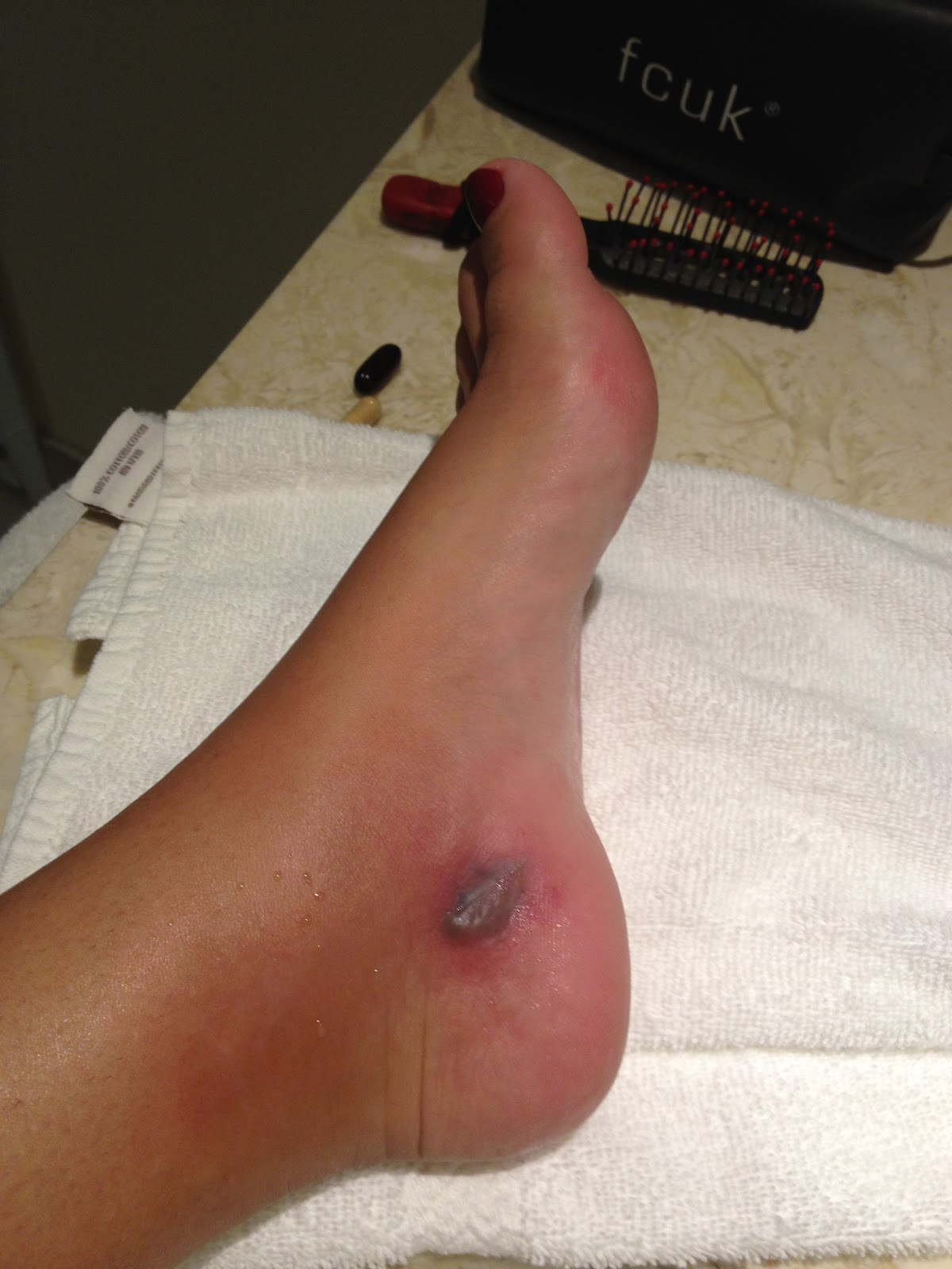 NewAmericanFoods.com: Stingray Sting, Aftermath & the Tasty Travels ...