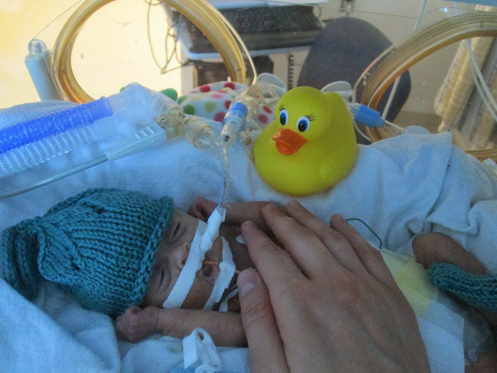 JAM sessions: Lessons learned through a micro-preemie: Week 32 ...