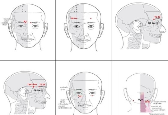 Acupuncture and Rehabilitation ( Road to full recovery): Acupuncture ...