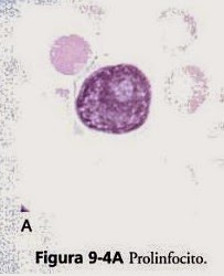 Hematologia: Serie Leucocitaria, Linfocito