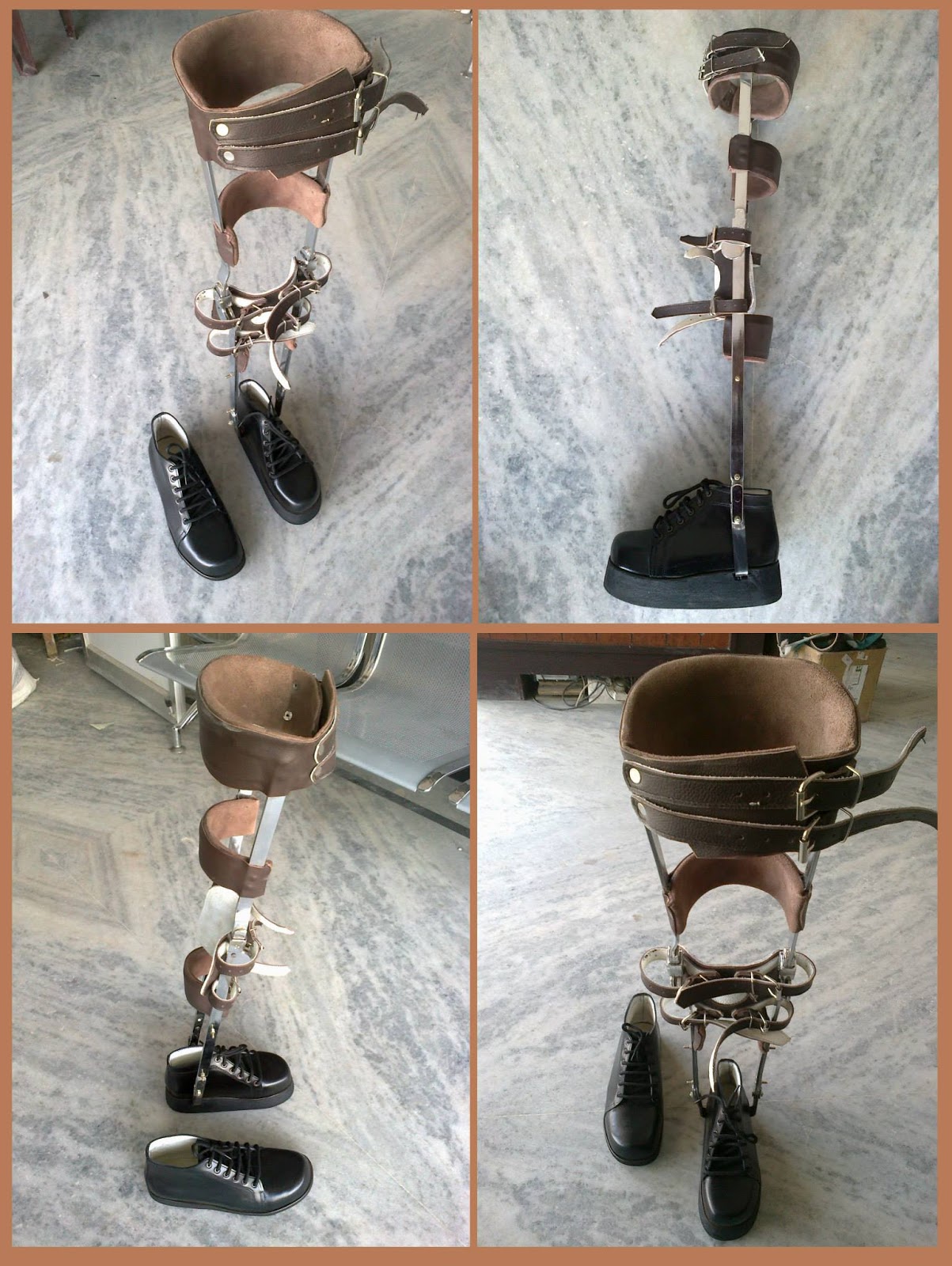 Prosthetics & Orthotics from My Care: Calipers for Polio Patients (KAFO)