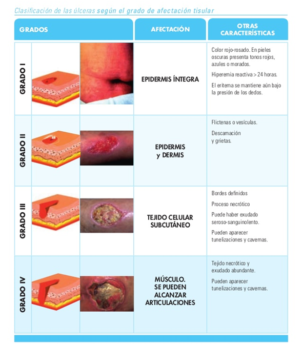 La web otra herramienta para el cuidado: ÚLCERAS: ¿QUÉ SON? ¿CÓMO SE ...