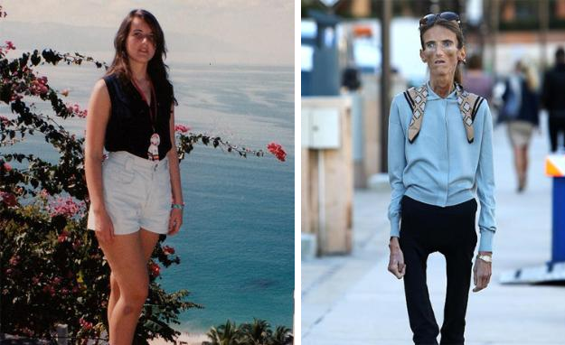 La donna più magra al mondo... (clicca la foto)