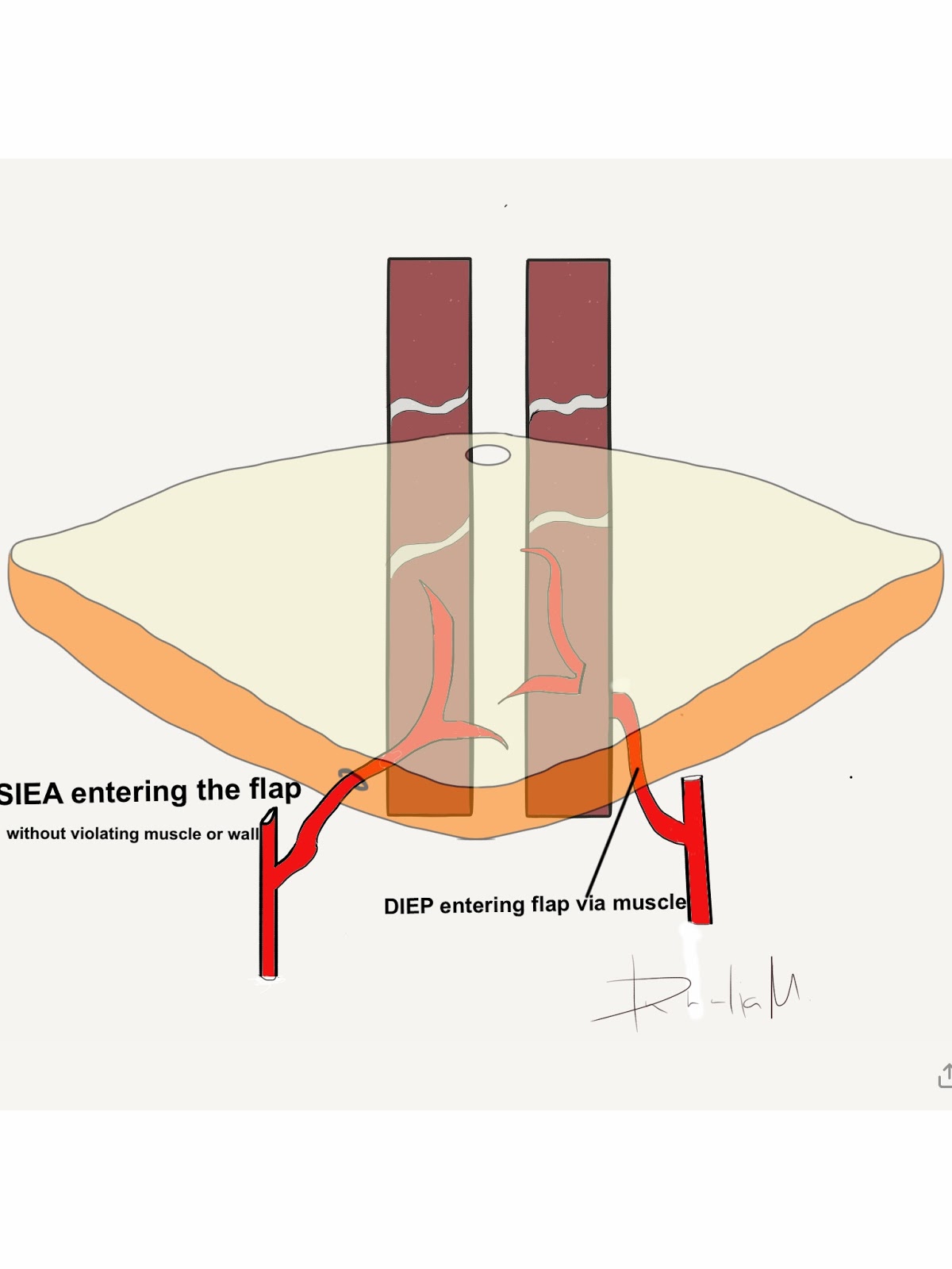 MI4 (Microsurgery Institute 4): Breast
