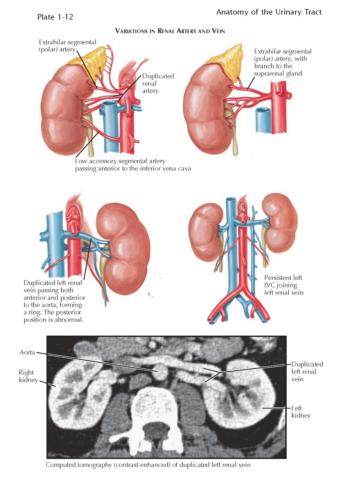 Renal Vasculature - pediagenosis