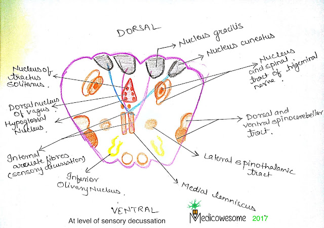 Medicowesome: Medulla (Fun Mnemonic Diagrams)