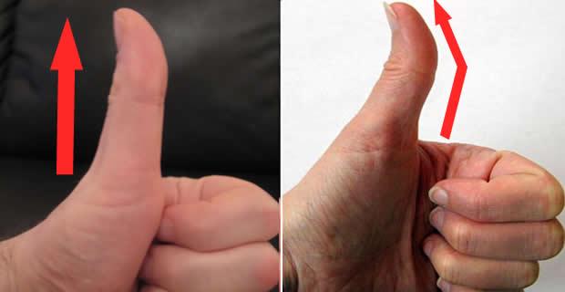 IS YOUR THUMB STRAIGHT OR CROOKED? HERE IS WHAT IT MEANS! - Useful info