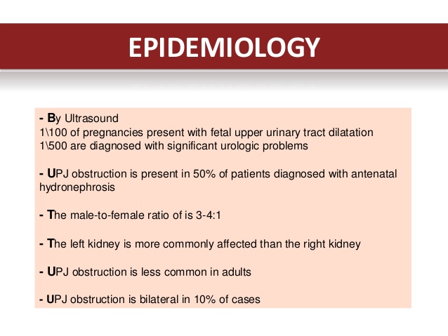 upj obstruction - USA News Collections