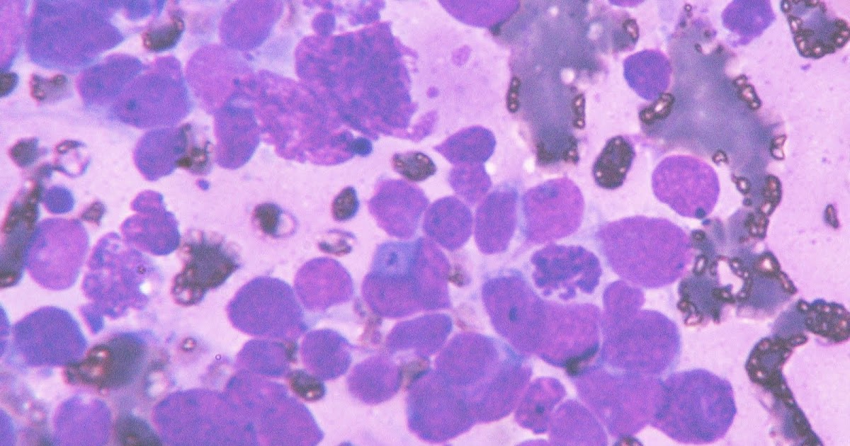 into the roots: A few crazy cells