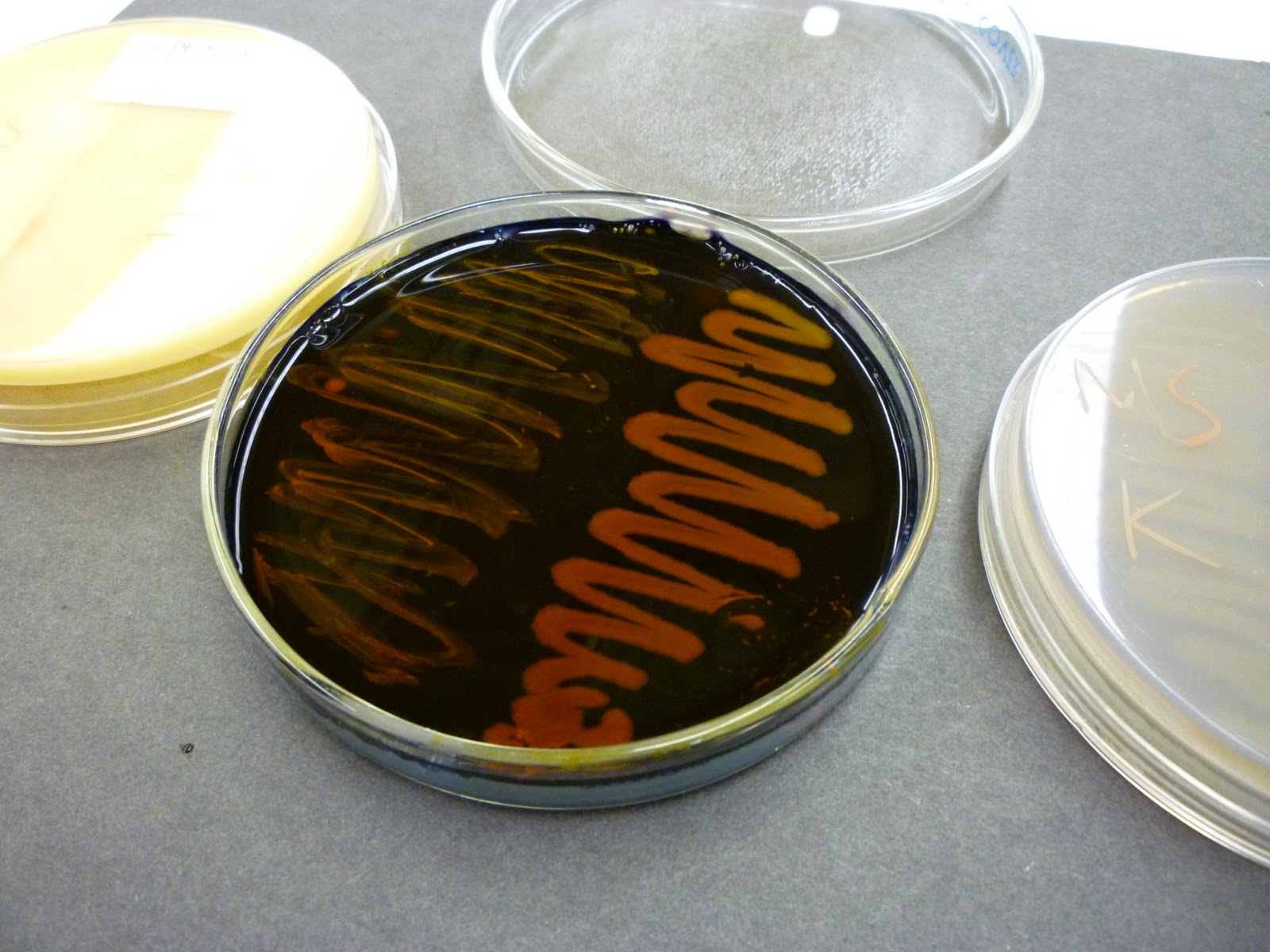 Medical Microbiology: October 13