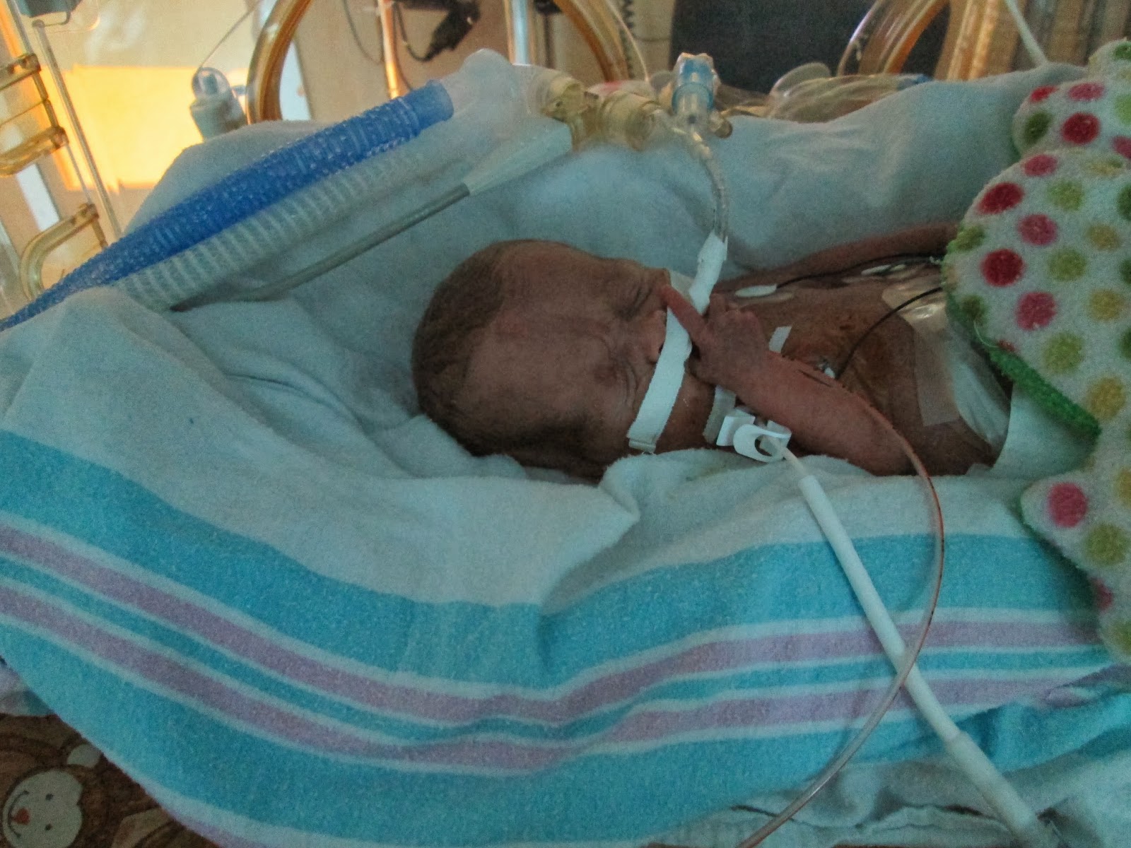 JAM sessions: Lessons learned through a micro-preemie: Week 32 ...