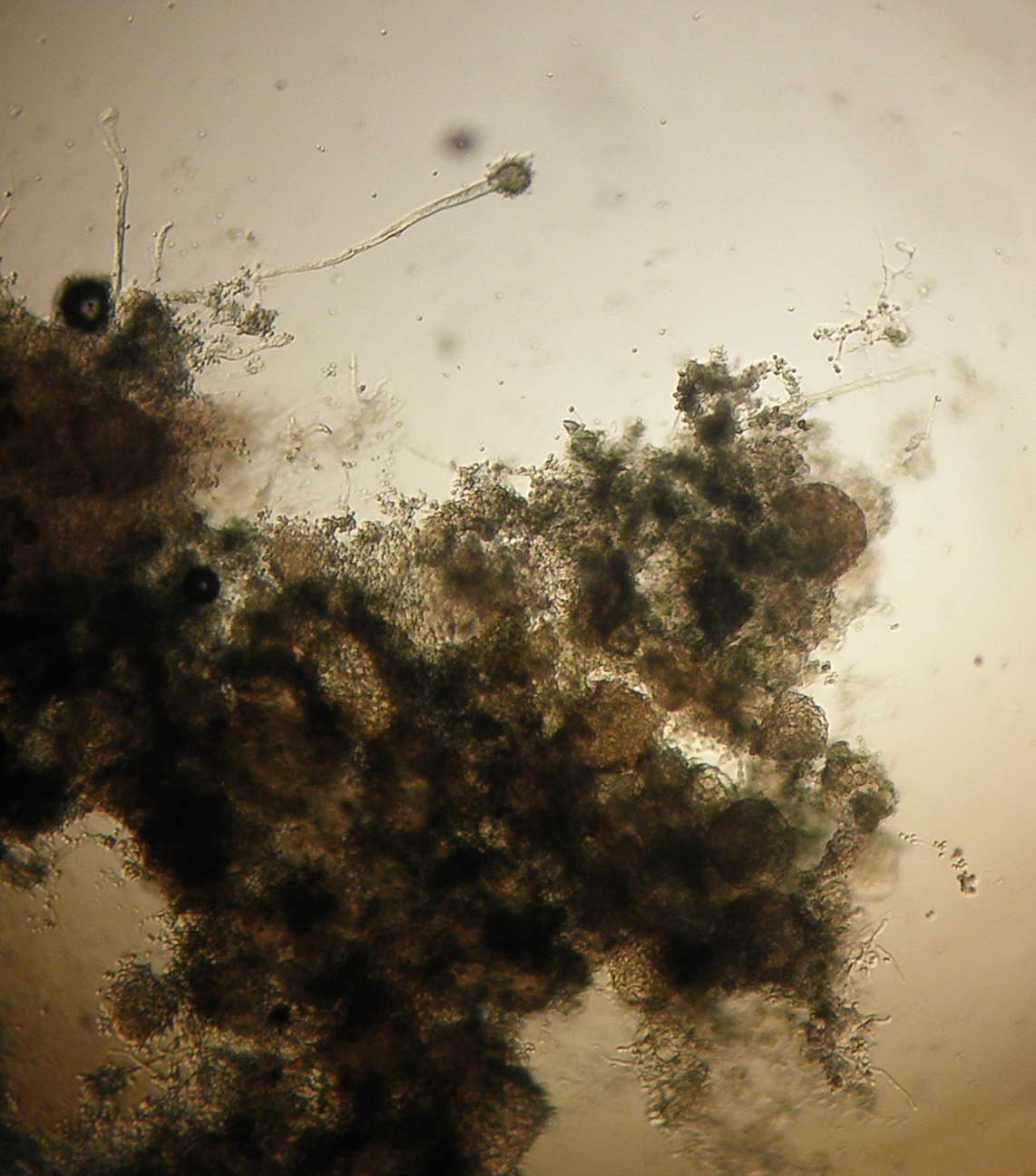 ATLAS MICOLOGIA: ASPERGILLUS GLAUCUS