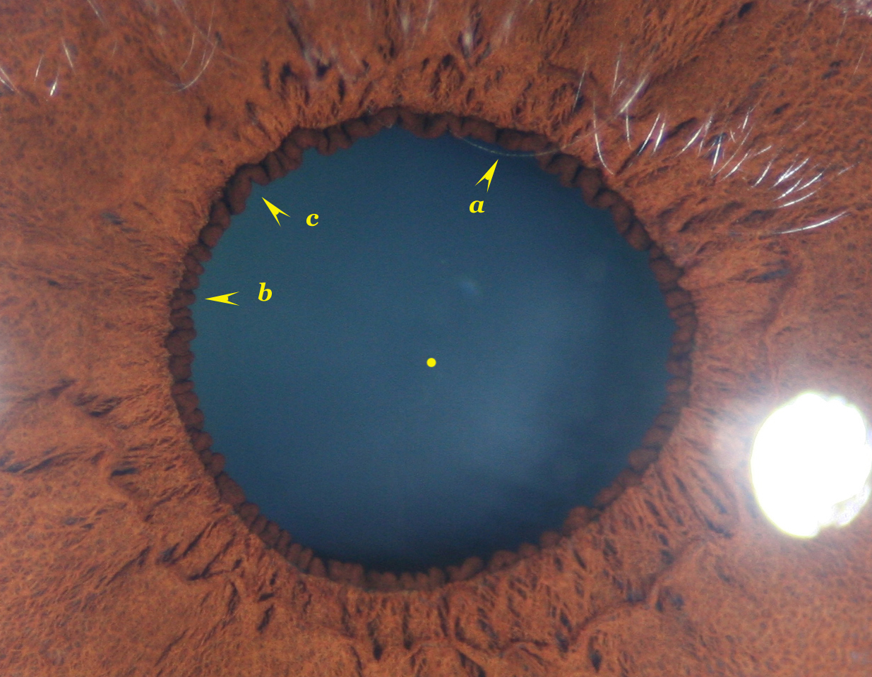 Modern & Multidimensional Iridology: IPB Morphologies - Classic & New ...