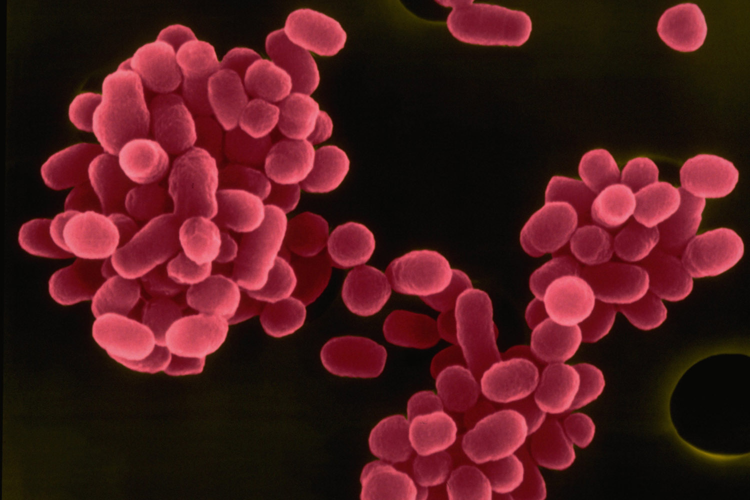 brucella: Brucelosis bovina