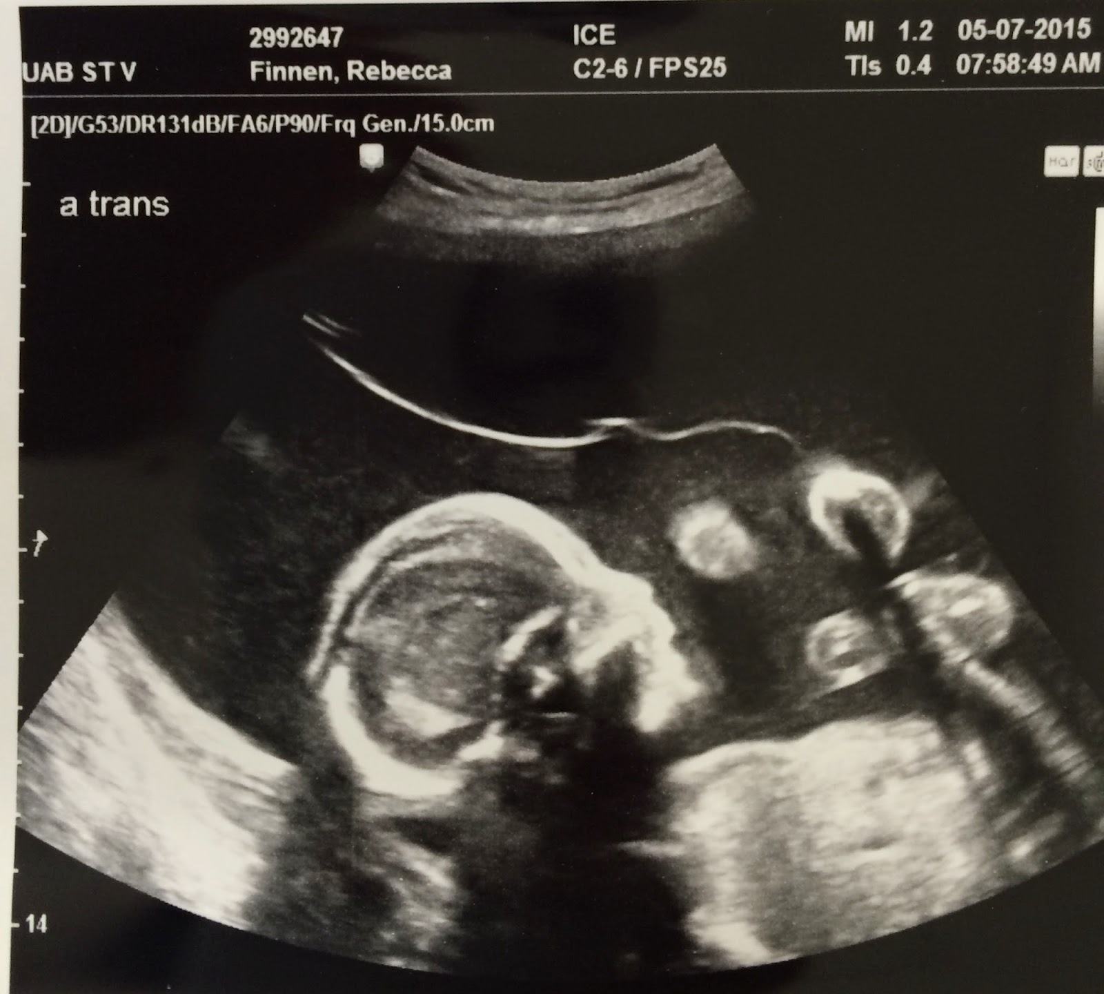 The Finnen Five: Level 3 Ultrasound