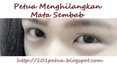 101 Petua: Petua Menghilangkan Mata Sembab