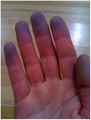 Reveal About Your Health through Hands ~ Info And Knowledge