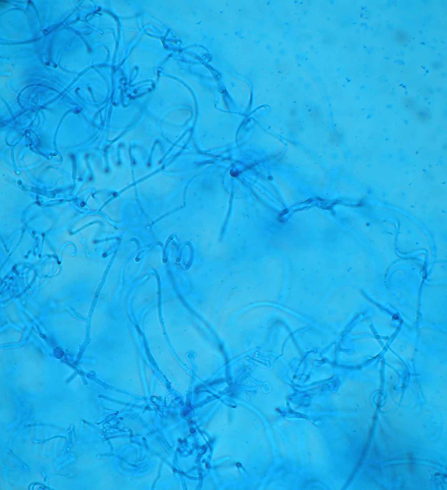 ATLAS MICOLOGIA: TRICHOPHYTON MENTAGROPHYTES
