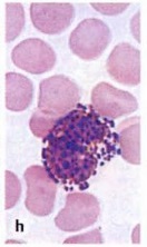 FICHERO HEMATOLOGIA : Basófilo
