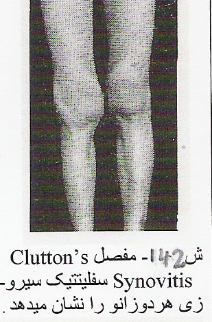 مطالب درسی برای محصلین طب : فصل12- قسمت4 و5 معاینه ماؤفیت مفصل زانو و ...