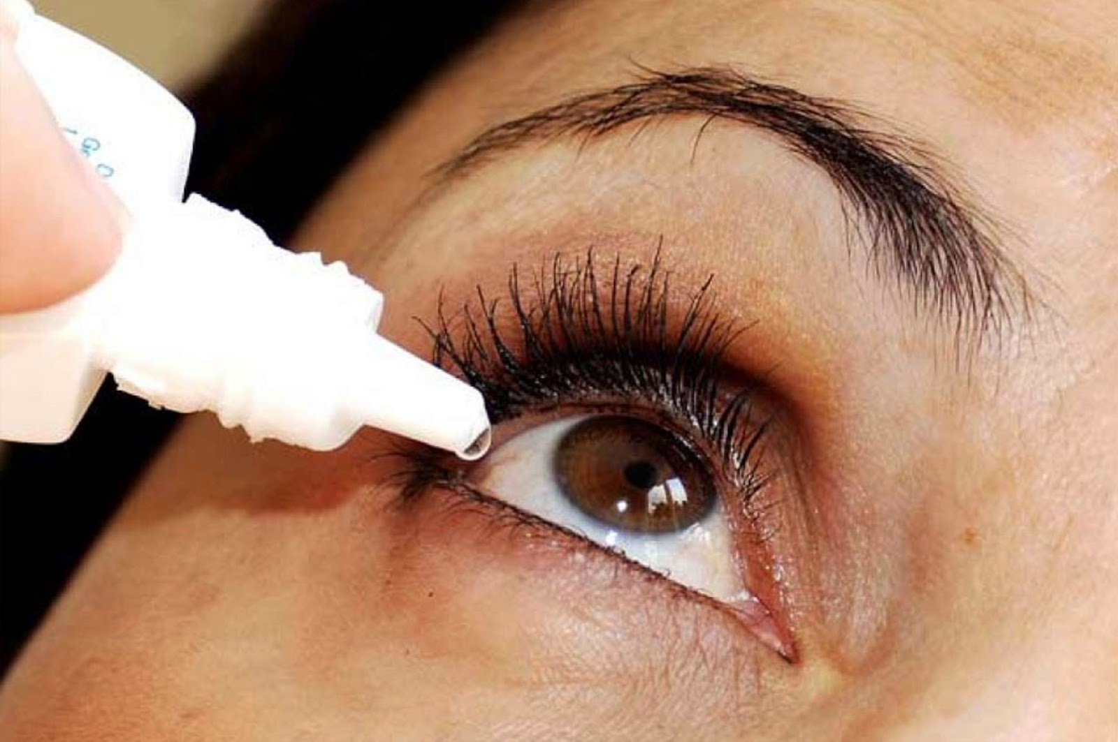 Carnosidad ocular - Salud en Casa Perú