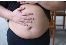 Here's how to shrink the Stomach quickly and effectively! - tipskesehatan