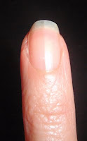 How to Handle a Hangnail
