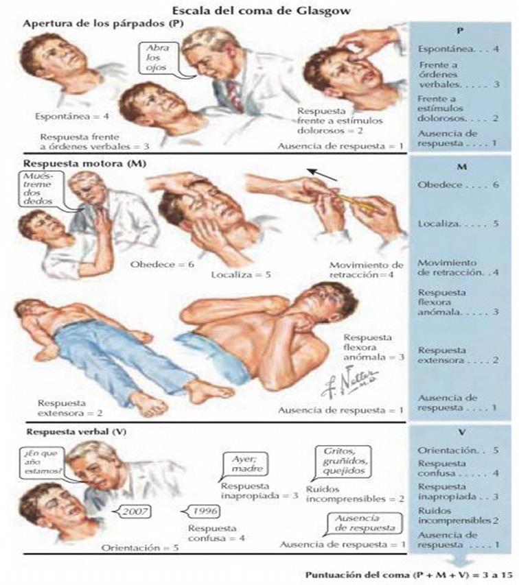 Health Updates: Glasgow Coma Score: