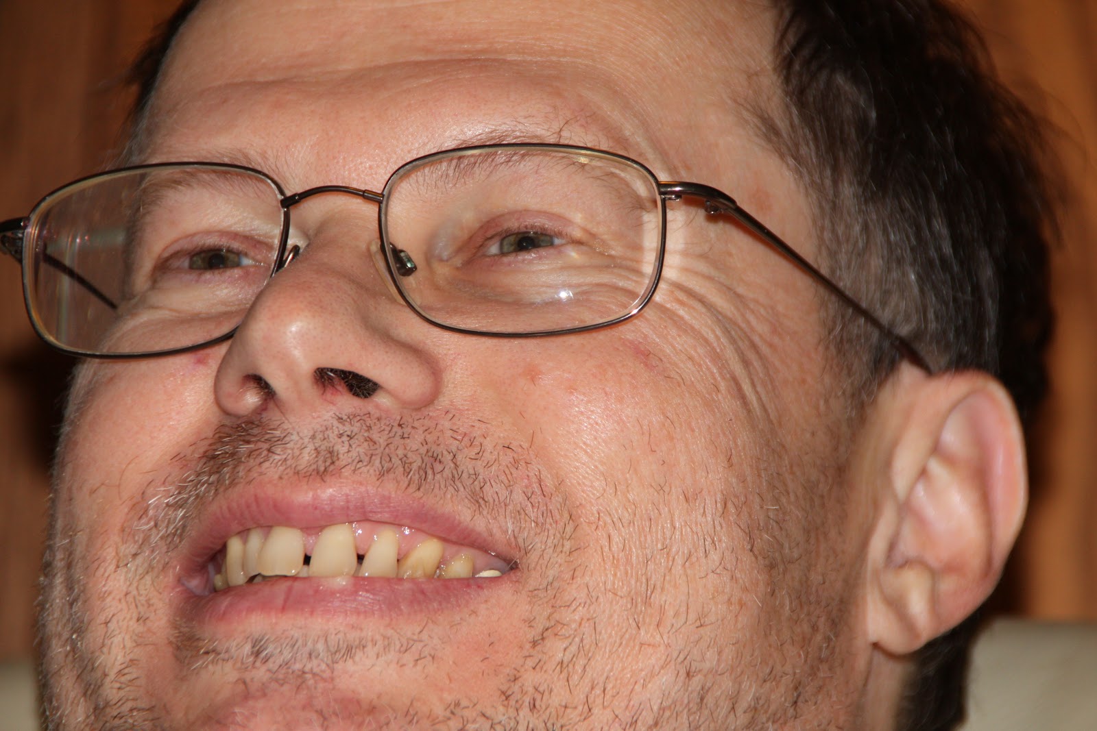 At Risk for Huntington's Disease: The incredible lightness – and ...