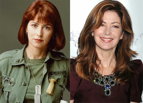 Dana Delaney Plastic Surgery Botox Injections Before and After Photos ...