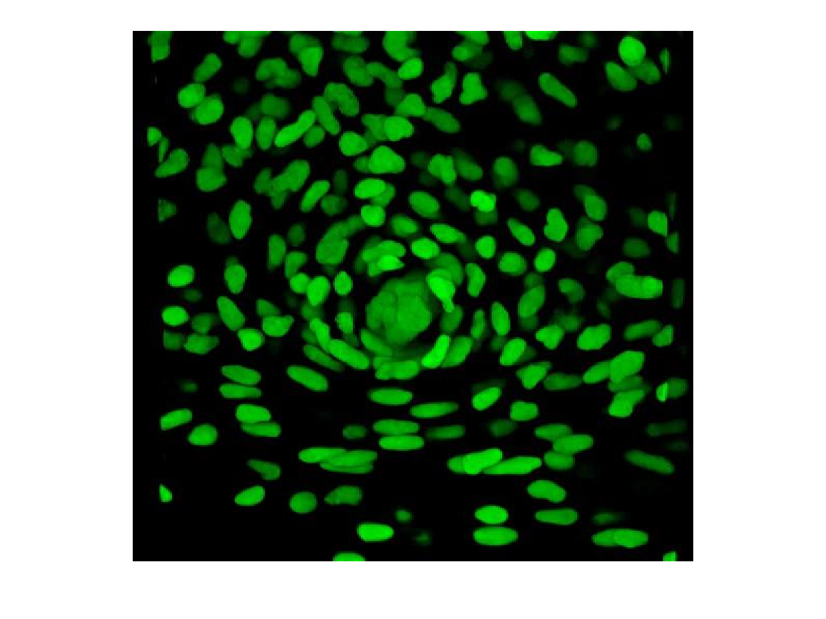 Basic cell counting and segmentation in Matlab