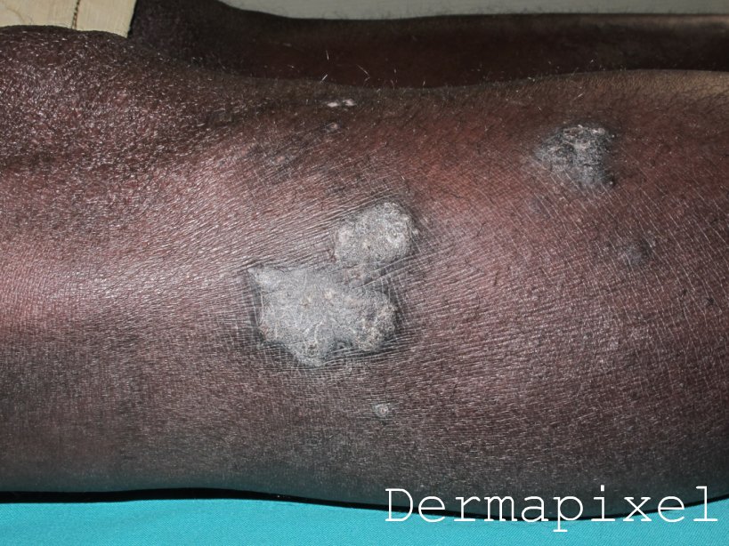 Dermapixel: junio 2012