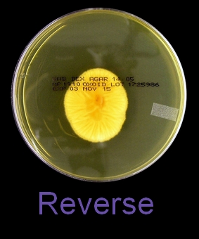 Fun With Microbiology (What's Buggin' You?): Sarocladium kiliense