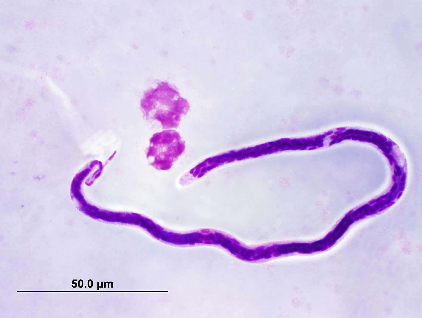 Loa Loa Microfilariae