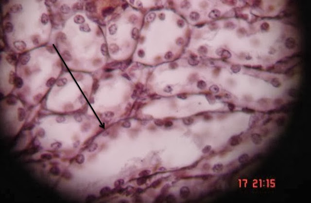 Atlas Histologia Animal: Fibras Retículares
