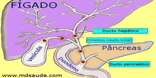 Sintomas de uma doença na vesícula biliar