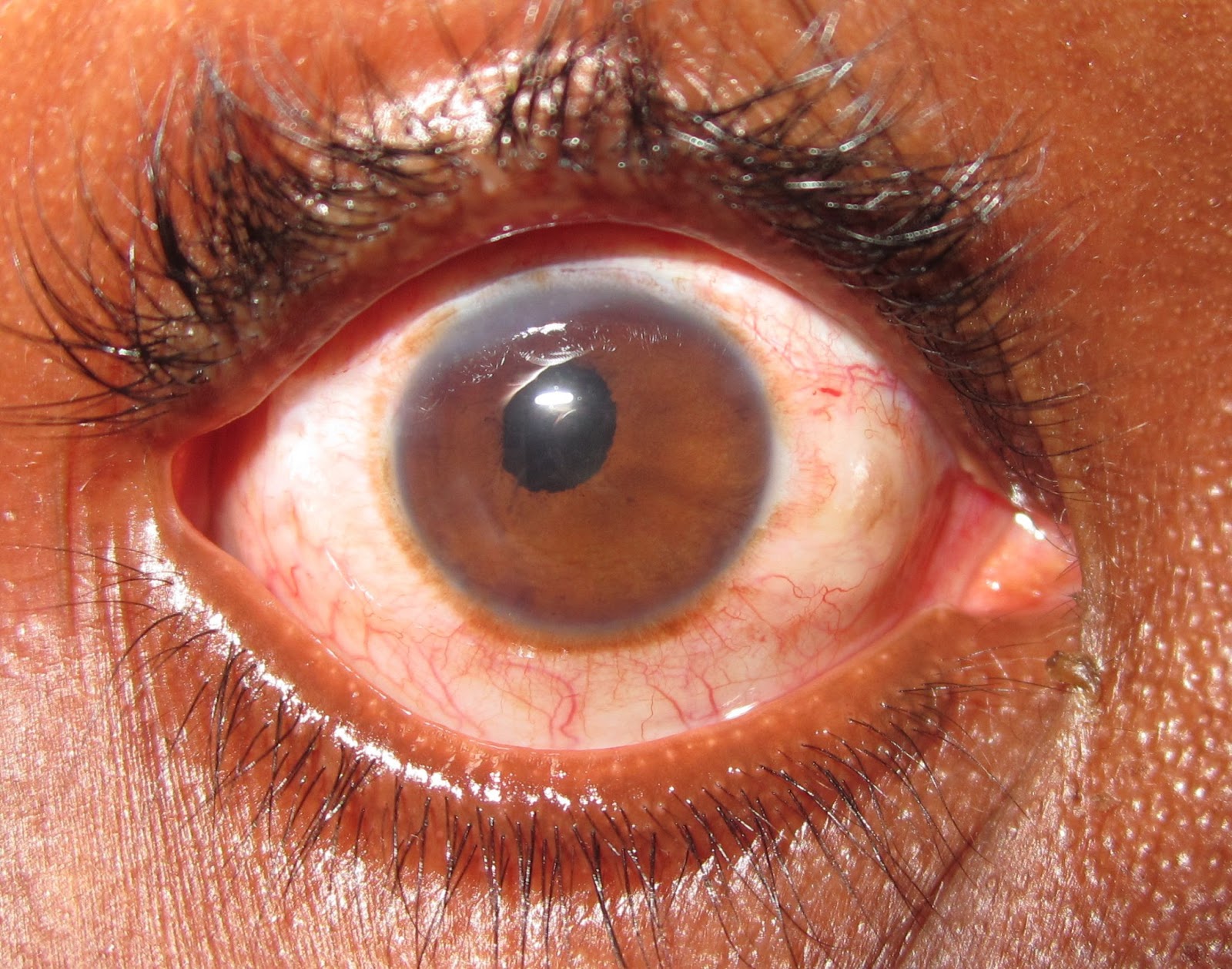 So Richly Blessed: He still cares for individuals