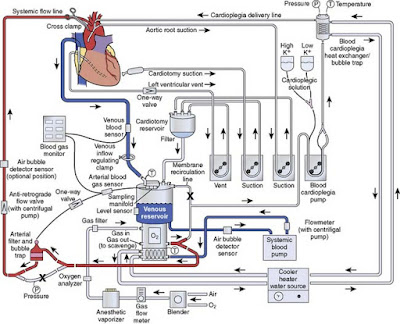 heart lung machine