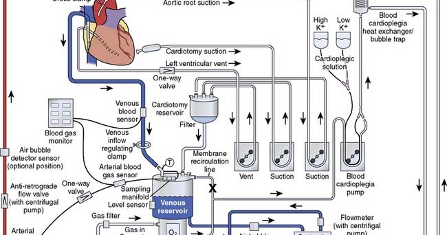 heart lung machine